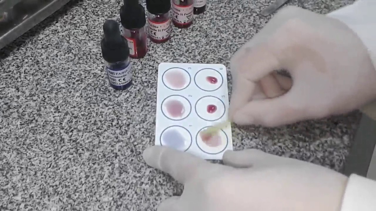 Rose Bengal Test - Microbiology Laboratory Turkey