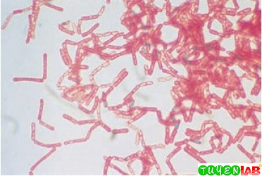 [Microbiology] Atlas of Aerobic Gram-Positive Bacilli | Free Medical Atlas