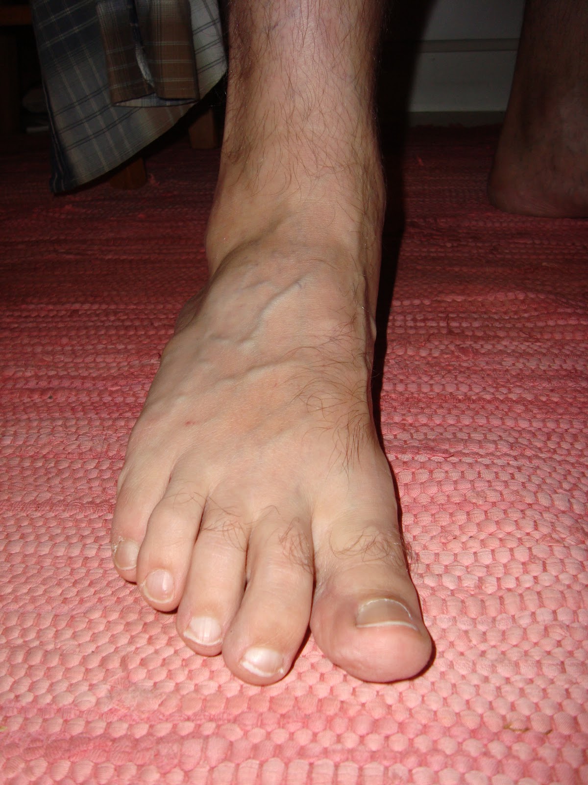 Rouva Kuulasen Lennokkaat Kuulat: Pronaatioita ja Jalkateräjumppaa