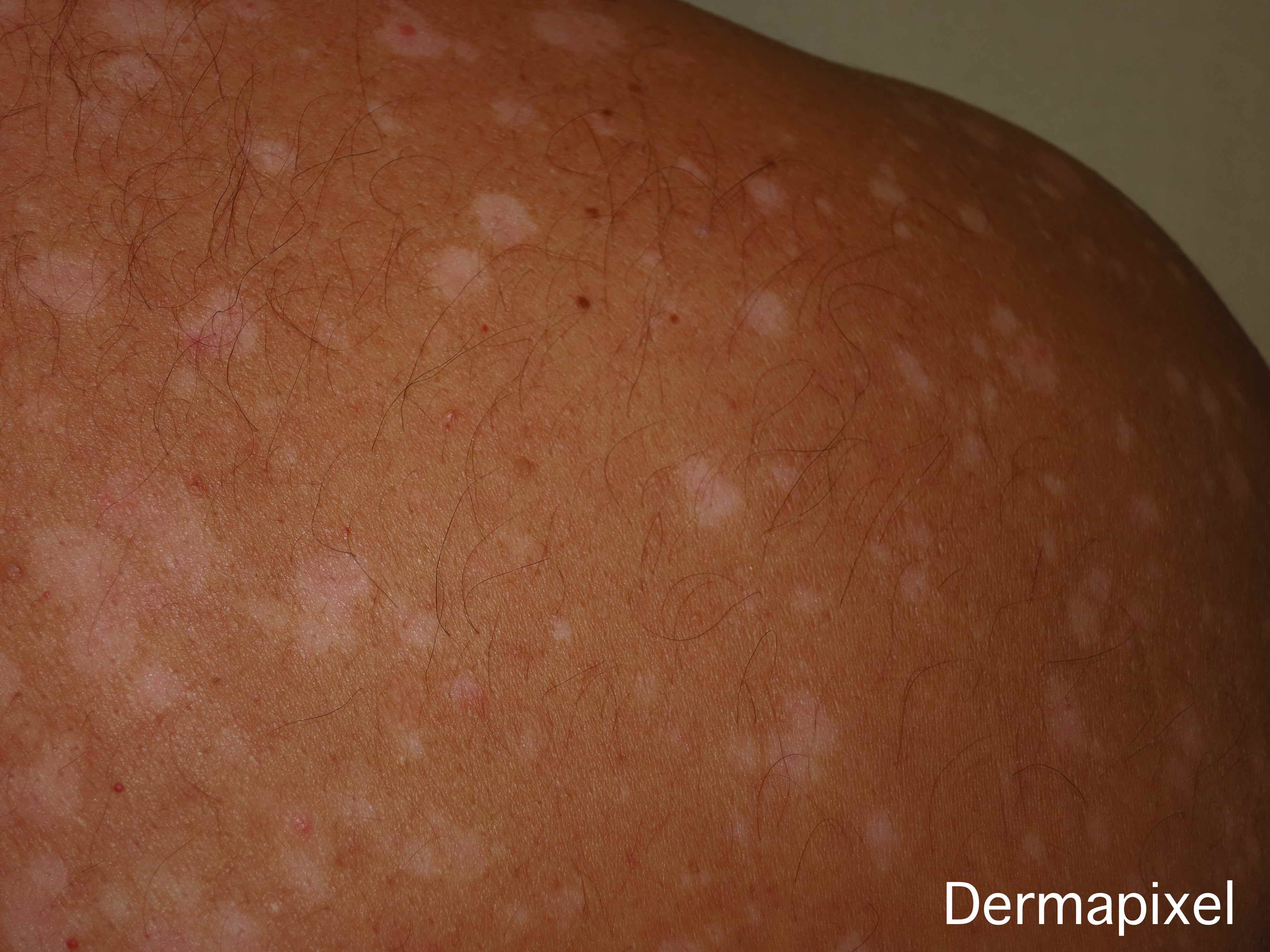 Dermapixel: febrero 2021