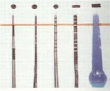 Poket Periodontal | Important thing