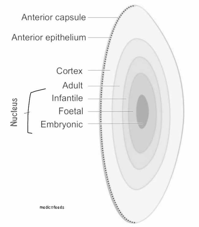 What is Cataract? causes, etiology pathophysiology