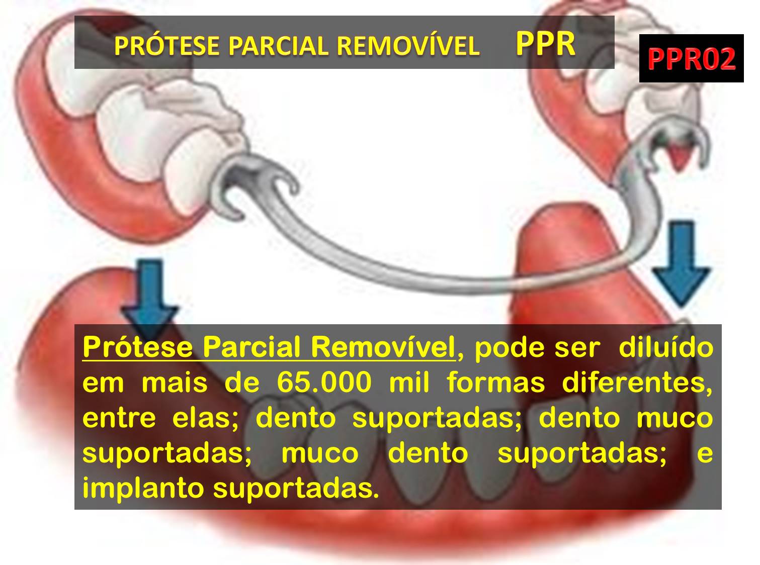 Professor Gilmar Zukowski gilmarprotese.blogspot.com : 3ºANO PPR ...