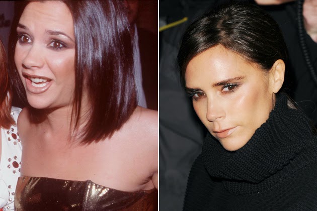 Morably — Victoria Beckham Before After - 11 photos