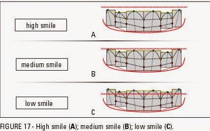 Omni Dental Group: Smile (Lip) Line