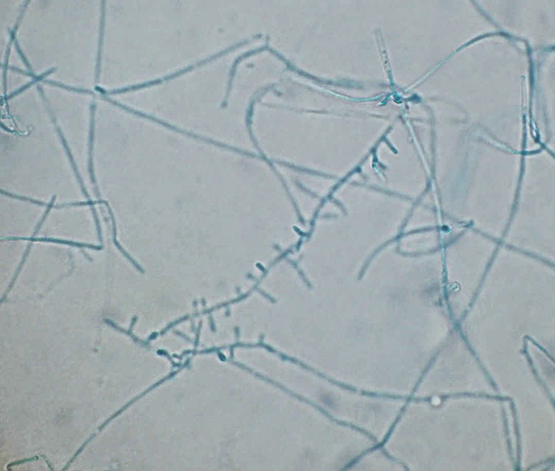 ATLAS MICOLOGIA: TRICHOPHYTON TONSURANS (2)