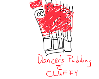 Foot and Ankle Problems By Dr. Richard Blake: Cluffy Wedge and Dancer's ...