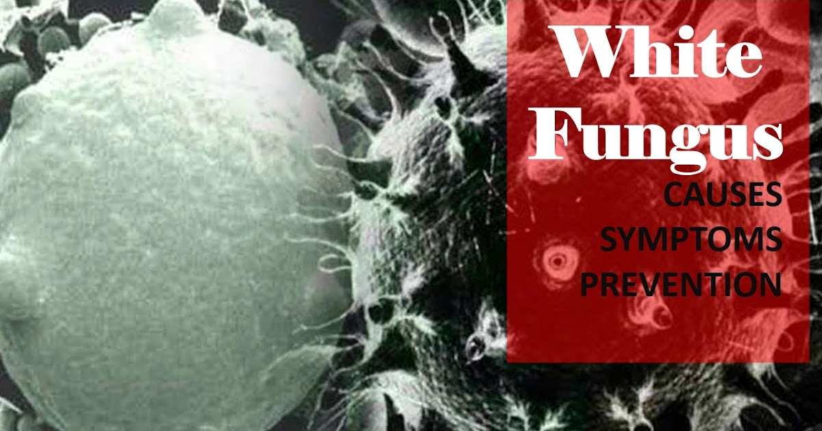 White Fungus: Causes, symptoms and prevention