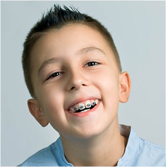 The Fastest Way to Straighten Teeth with Orthodontic Treatment