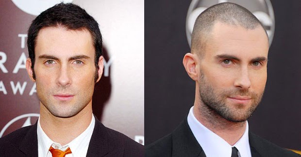 The Voice USA Judge Adam Levine Had his Hair Transplanted ~ SIZZLING ...