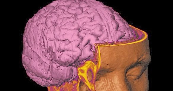 The Body Blog: Bigheads