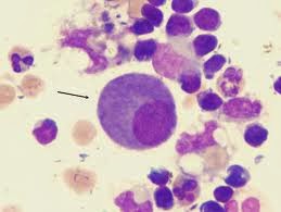 The mesothelial cell. | Mesothelium