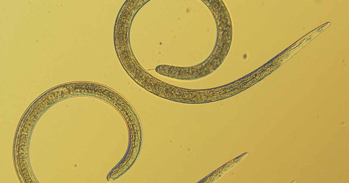 Parasite of the Day: Trichinella britovi