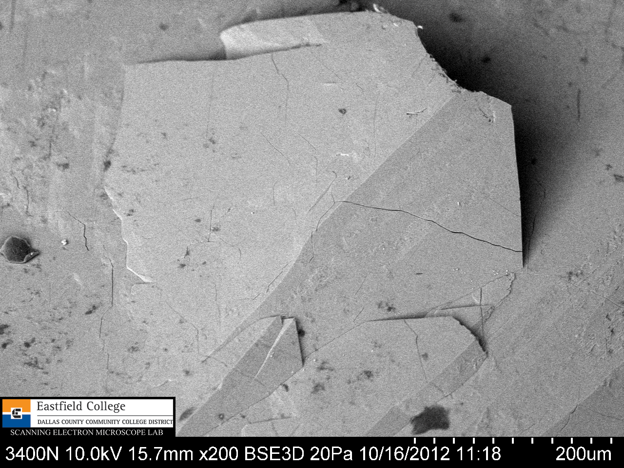 Scanning Electron Microscope Blog: A Kidney Stone - OUCH!!