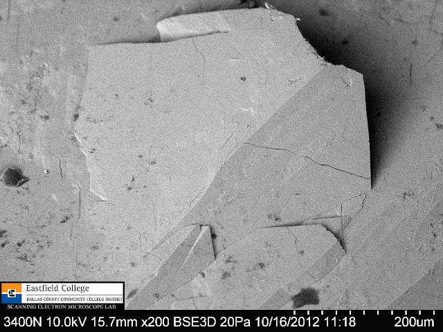 Scanning Electron Microscope Blog: A Kidney Stone - OUCH!!