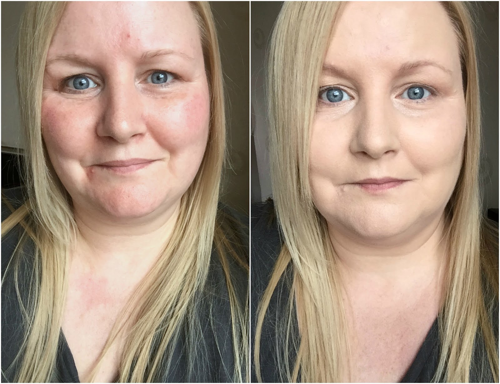 Vichy Dermablend Foundation Review Beforeafter Shots New Skincare ...