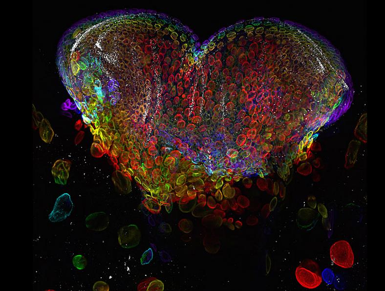 Un Mundo en Paz: En fotos: Los increíbles detalles del mundo microscópico