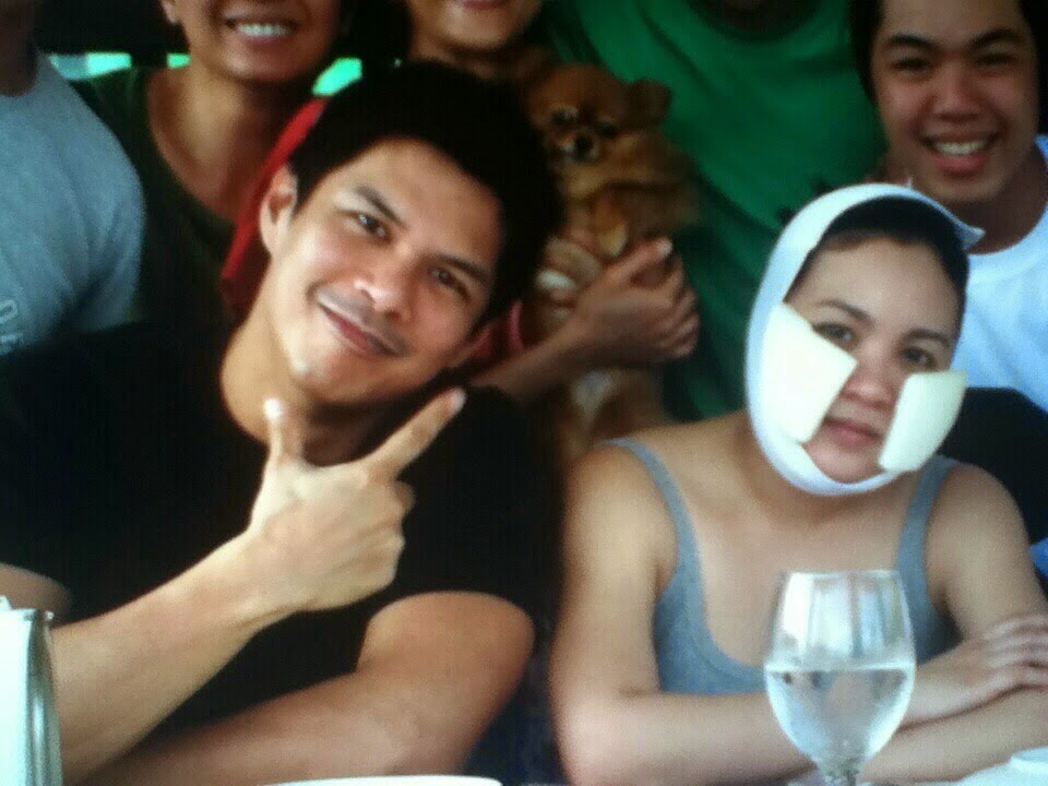 PHOTOS: Raymart Santiago reveals 'truth' behind Claudine Barretto's bruises