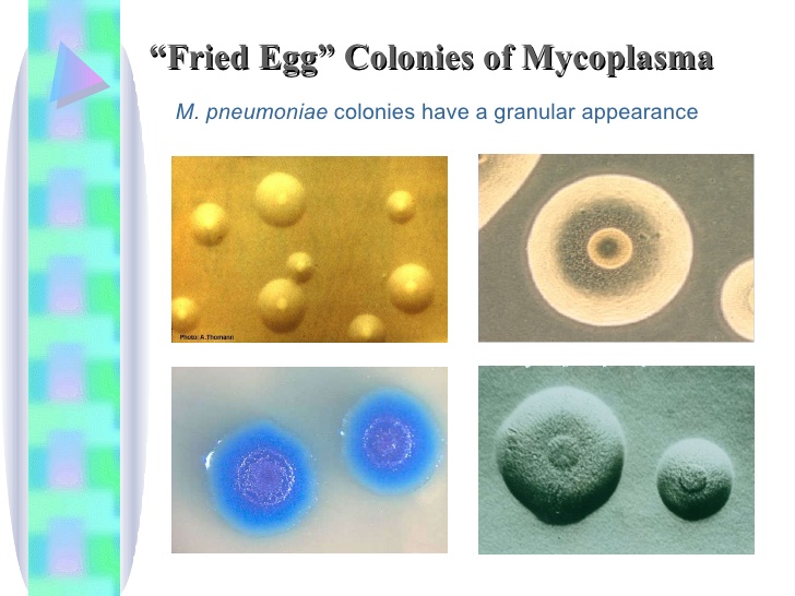 Lecture Notes in Medical Technology: Lecture #15: RICKETTSIA, CHLAMYDIA ...