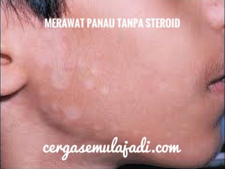 MERAWAT PANAU TANPA KRIM STEROID DAN SECARA SEMULAJADI | Sihat dan ...