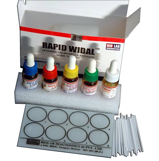 Widal Test : Principle, Procedure, and Result