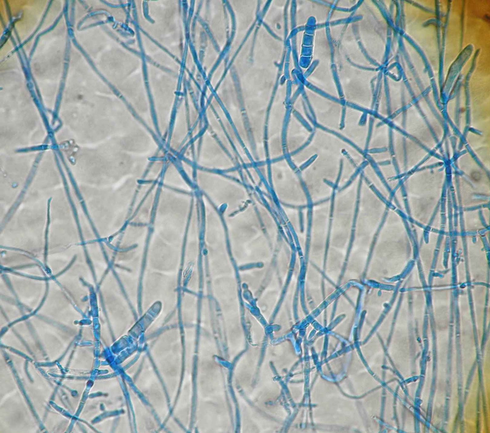 ATLAS MICOLOGIA: TRICHOPHYTON INTERDIGITALE
