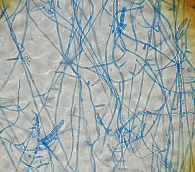 ATLAS MICOLOGIA: TRICHOPHYTON INTERDIGITALE