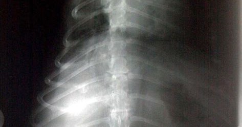 Art-Sci: Gulp! Swallowed Objects Revealed by X Rays