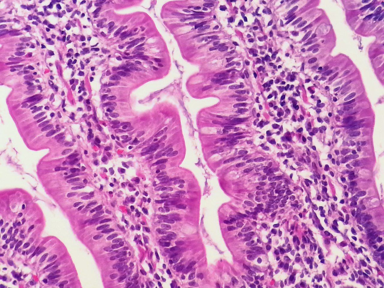 Morfofisiopatología y Citodiagnóstico: Íleon