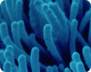 Kinésithérapie Respiratoire 9.5 : Drainage Bronchique Partie 1