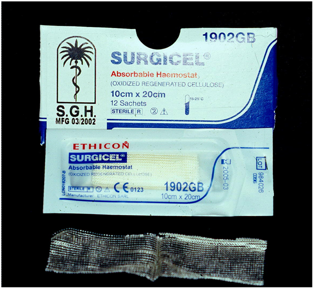 Dentistry and Medicine: Diagnosis and Management of Hemorrhage in Oral ...