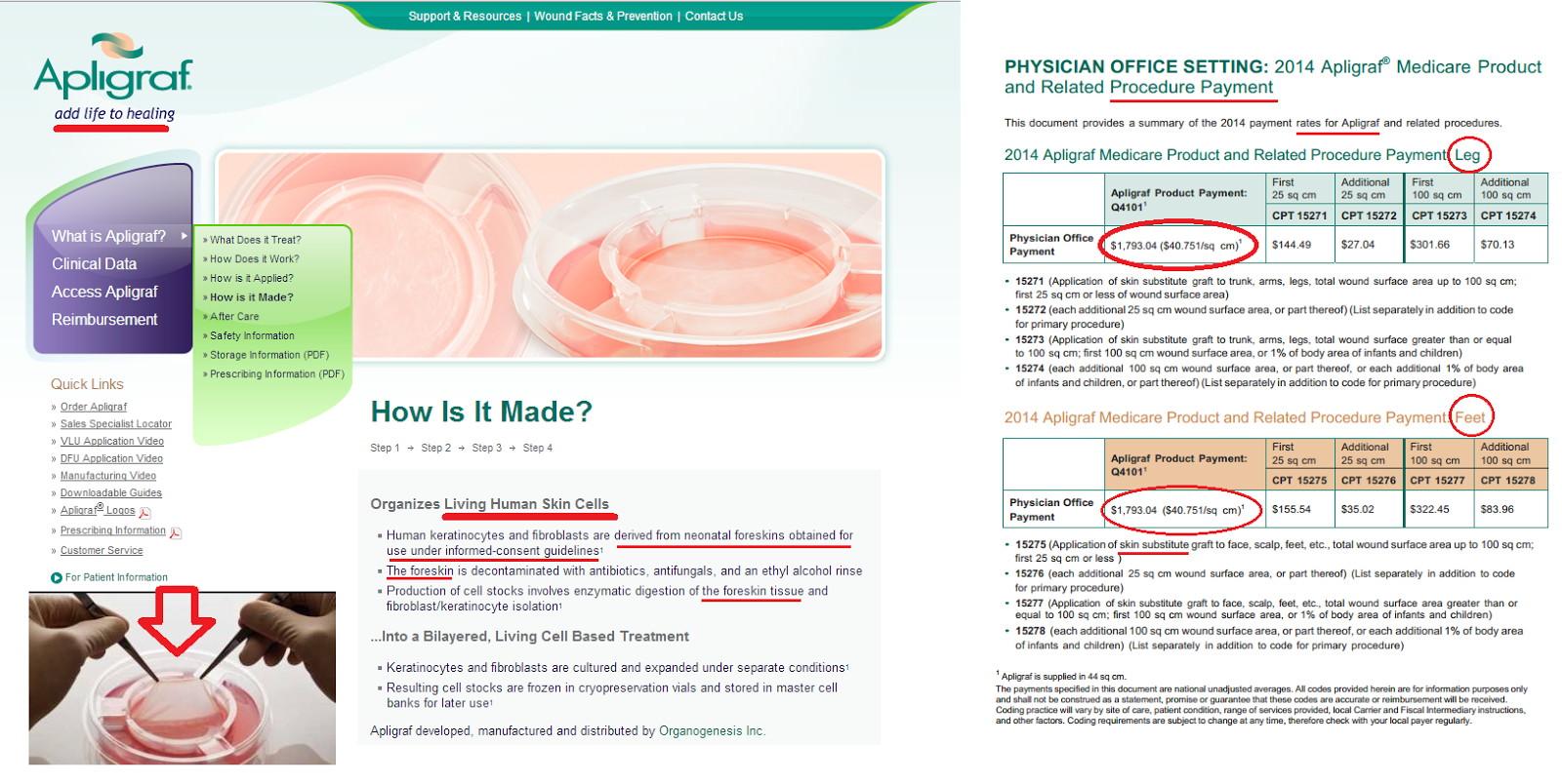 CIRCUMCISION INSANITY: The Unspeakable Horror Of Apligraf