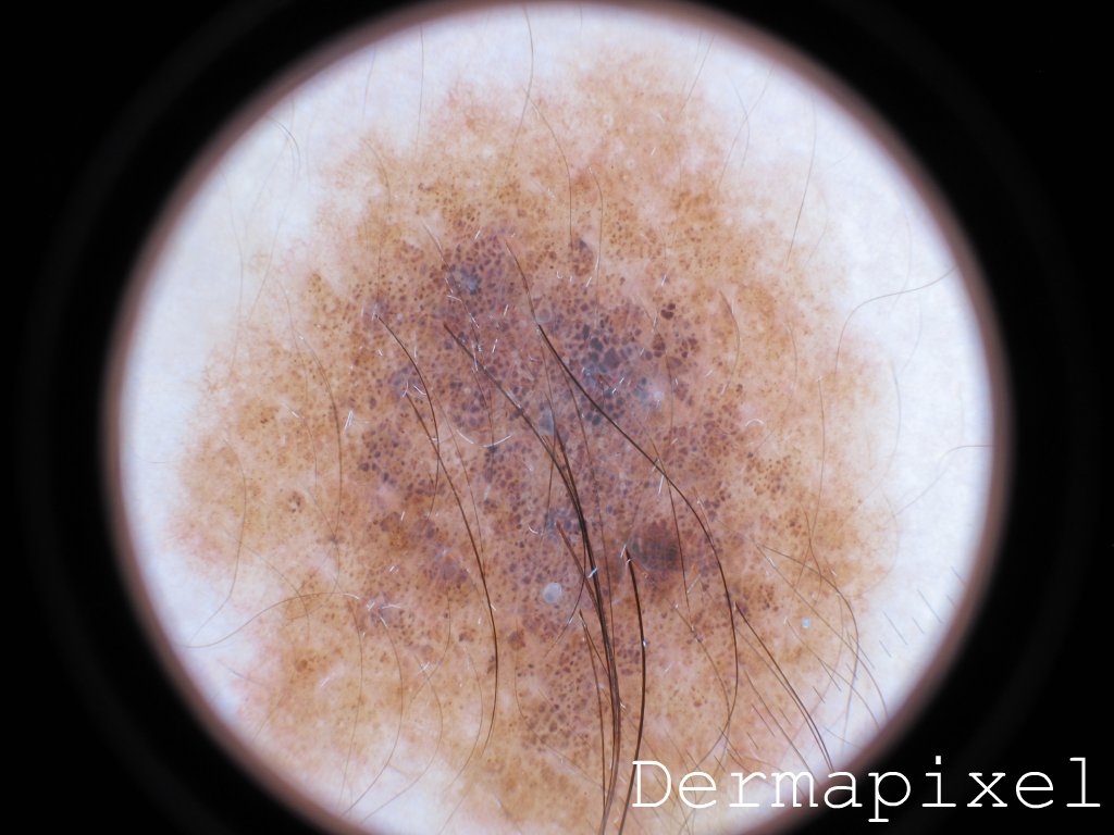 Dermapixel: mayo 2013