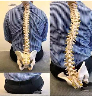 Singapore Hijama Bekam, Bone Alignment Therapy, Gurah Resdung ...