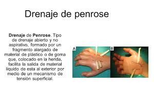 EL BLOC DE UNA AMIGA TCAE: DRENAJES QUIRÚRGICOS