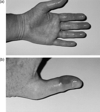 ER goldbook: Marine trauma and envenomation