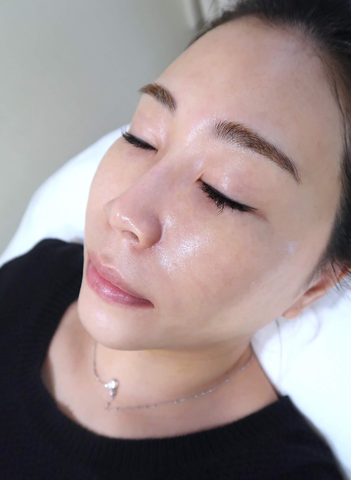 Makeup Secret: 呢個 treatment 真係好顛要試! 唔試後悔! Wiish Derma「等離子細胞再生療程」