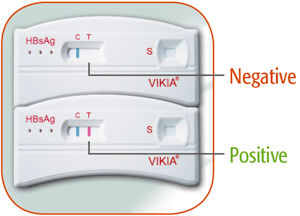 HBsAg Test | What Does It Mean Positive or Negative Results | Cassette ...