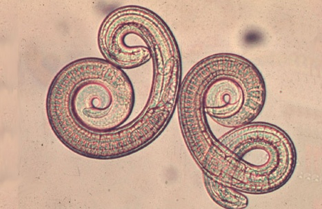 enfermedades preventivas: Triquinosis