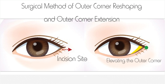 Eyelid Surgery Legend Dr. Kim Byung Gun: [BK Plastic Surgery Hospital ...