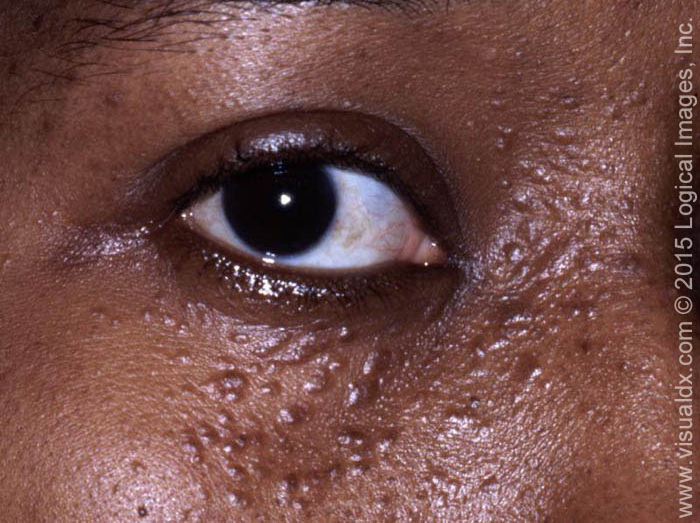 EL RINCÓN DE LA MEDICINA INTERNA