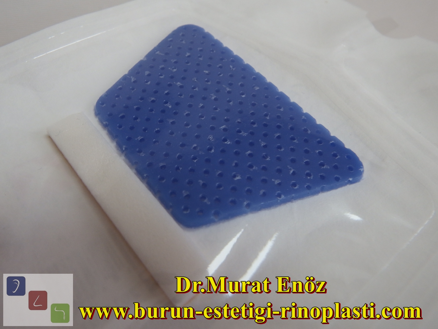 Health Zone Turkey: Why is External Nasal Splint Used After Rhinoplasty ...