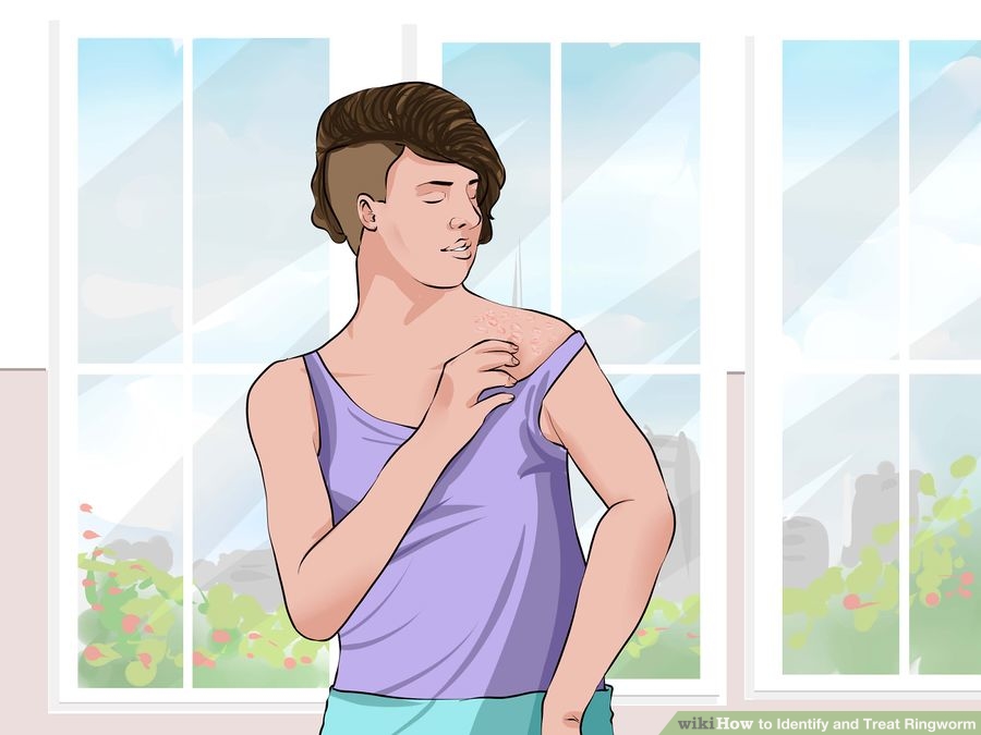 Advanced Skin Clinic: How to Identify and Treat Ringworm