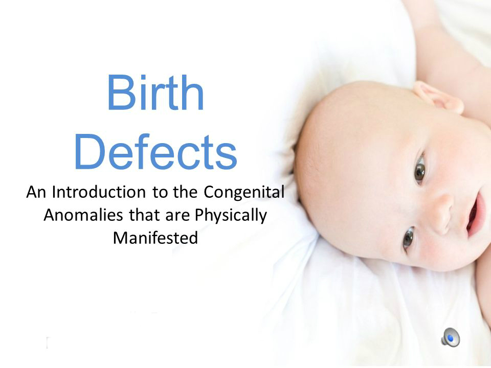 What are birth defects in baby? - Baby Care Tips