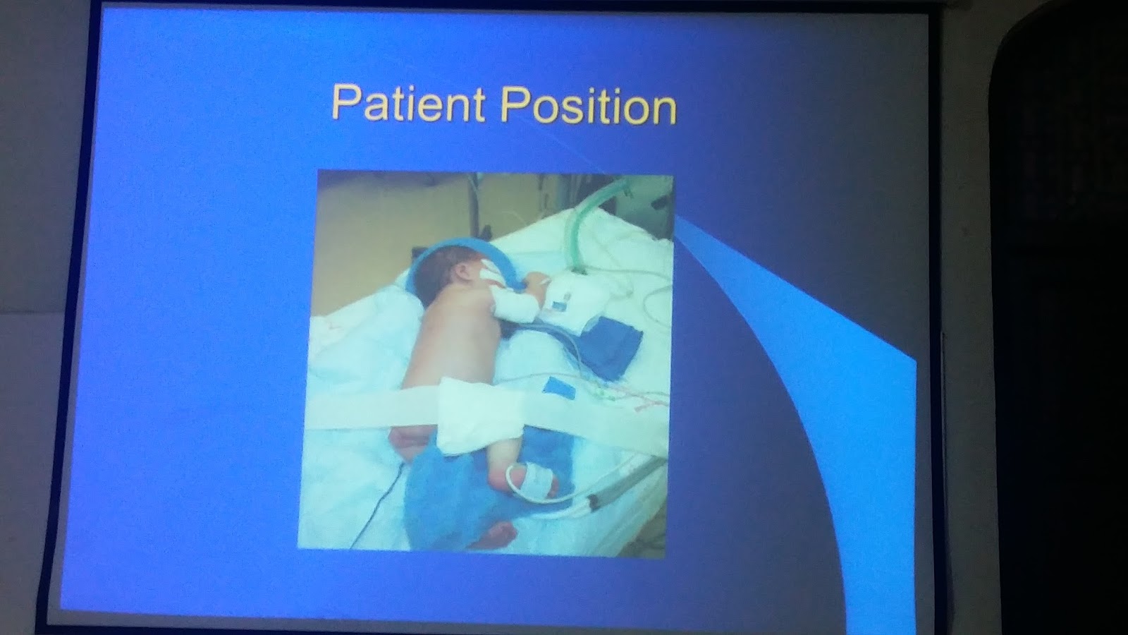 Lecture Slides; Paeds Surgery; Tracheoesophageal fistula n cong ...