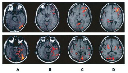 Gurney Journey: Brain scans of artists while drawing