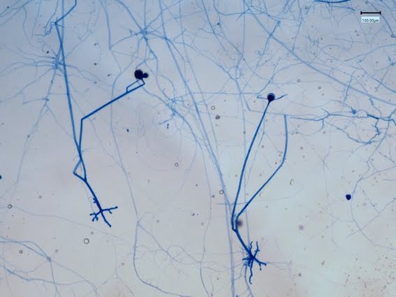 Fun With Microbiology (What's Buggin' You?): Absidia corymbifera ...