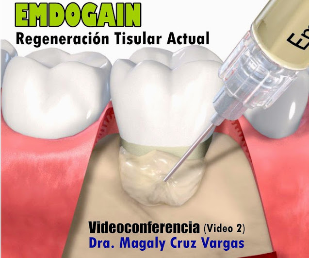 WEBINAR: EMDOGAIN y Regeneración Tisular Actual - Dra. Magaly Cruz ...