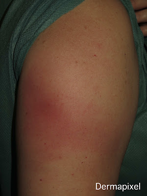 Dermapixel: agosto 2021