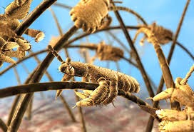 Itchy Monkeez - Kopluis kenners - Pretoria Oos: 2015